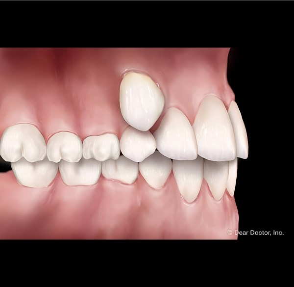 Common Orthodontic Problems & Solutions